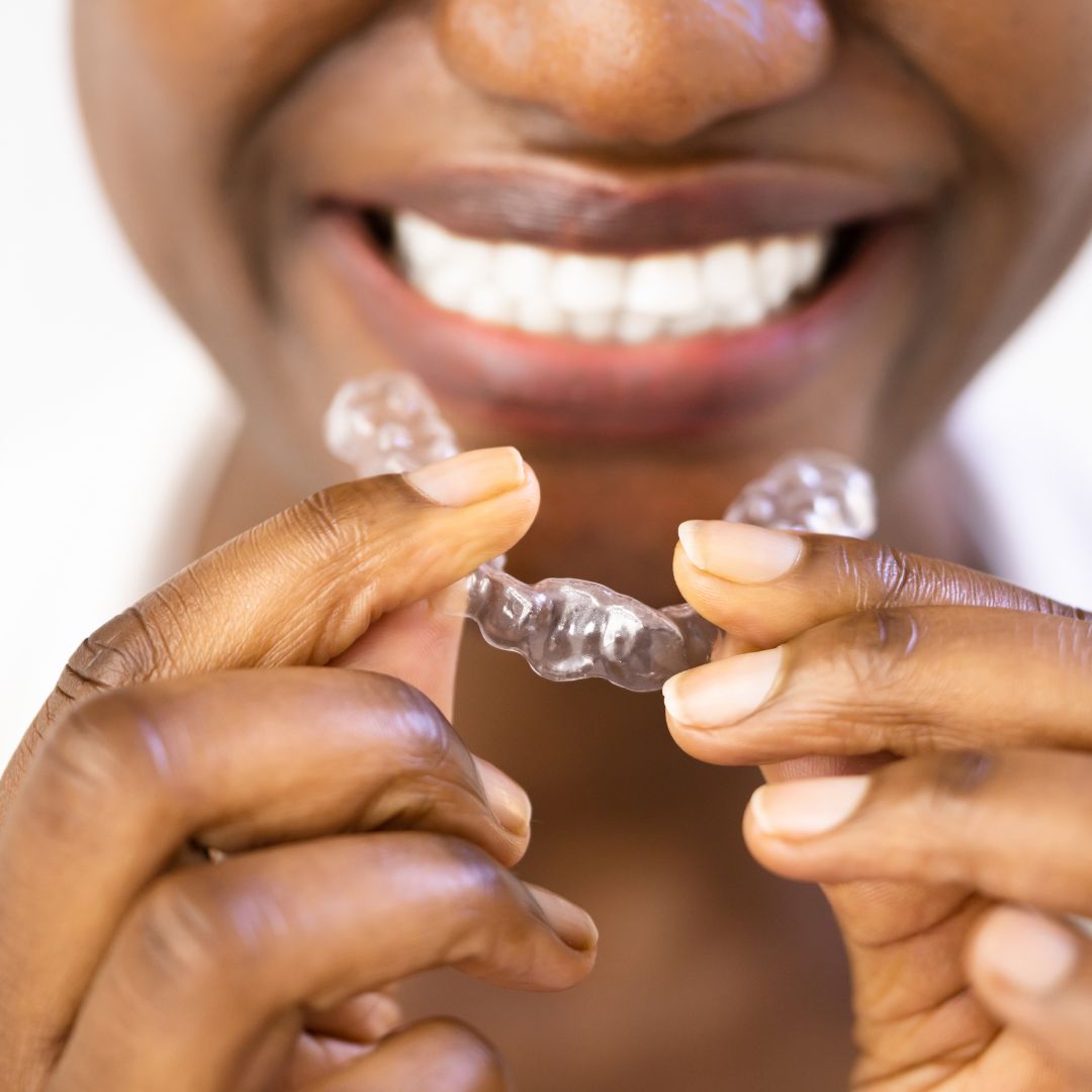 Why Dental Night Guards Can Help with Headaches: Insights from Your ...